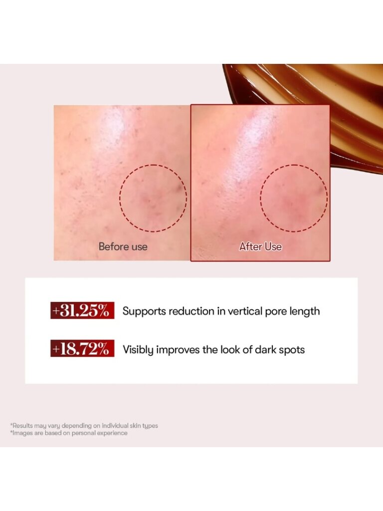 VT Red Booster Reedle shot 100- Ενισχυτικό με τεχνολογία microneedle ...